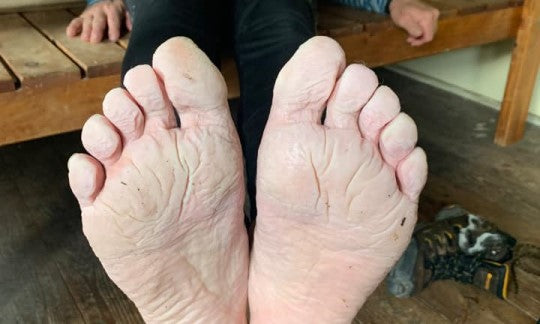 5 tips to keep your feet blister free when trail running. – Further Faster